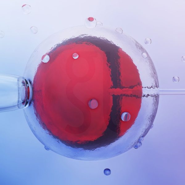 What is IVF? A Complete Guide to In Vitro Fertilization - GynoLife IVF